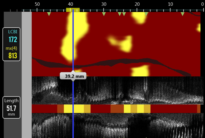 Cardiography : Online learning portal for Cardiologists